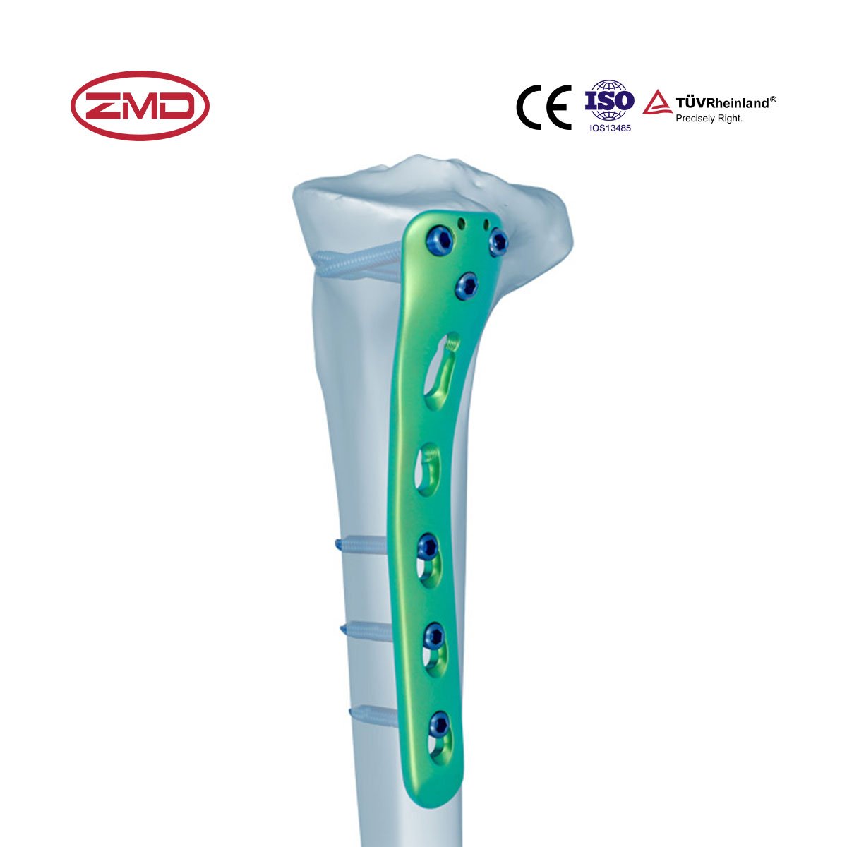 Multi-Axial Tibia Distal Medial Locking Plate II - Pharmaceutical Company