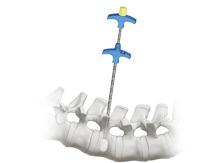Puncture System - Pharmaceutical Company