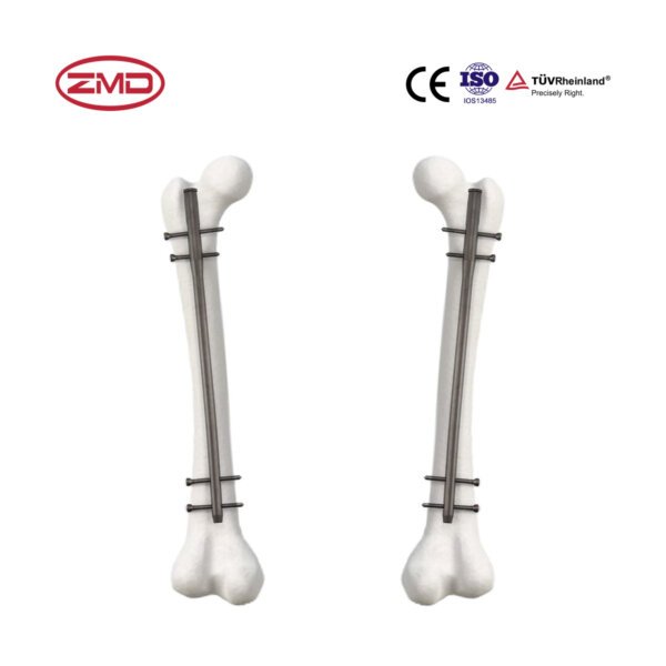 Tibial Multi-Direction Lockable Intramedullary Nail - Pharmaceutical ...