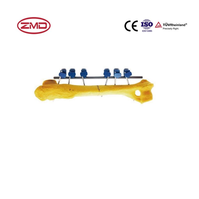 Unilateral External Fixator - Pharmaceutical Company