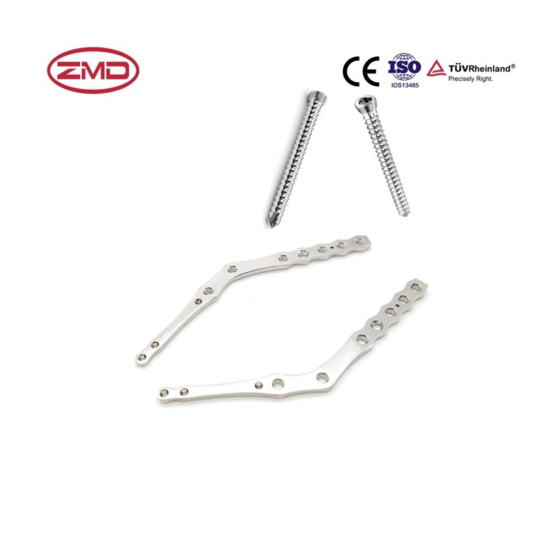 Wrist (Ankle) Joint Fusion (Cross-Joint Fixation) Dedicated Locking ...