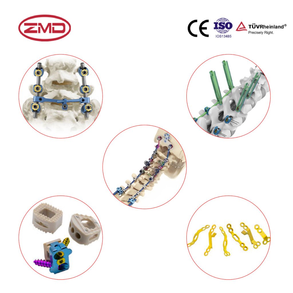 Posterior Cervical Screw System 3.5mm Pre-bent rod - Pharmaceutical Company