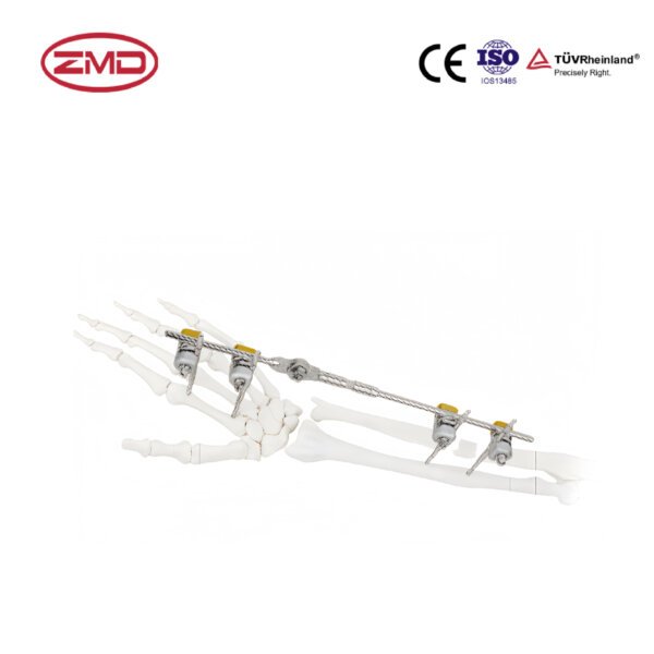 Combined Wrist Joint External Fixator - Pharmaceutical Company