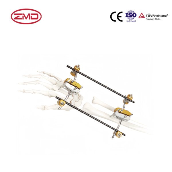 Combined Wrist Joint External Fixator - Pharmaceutical Company