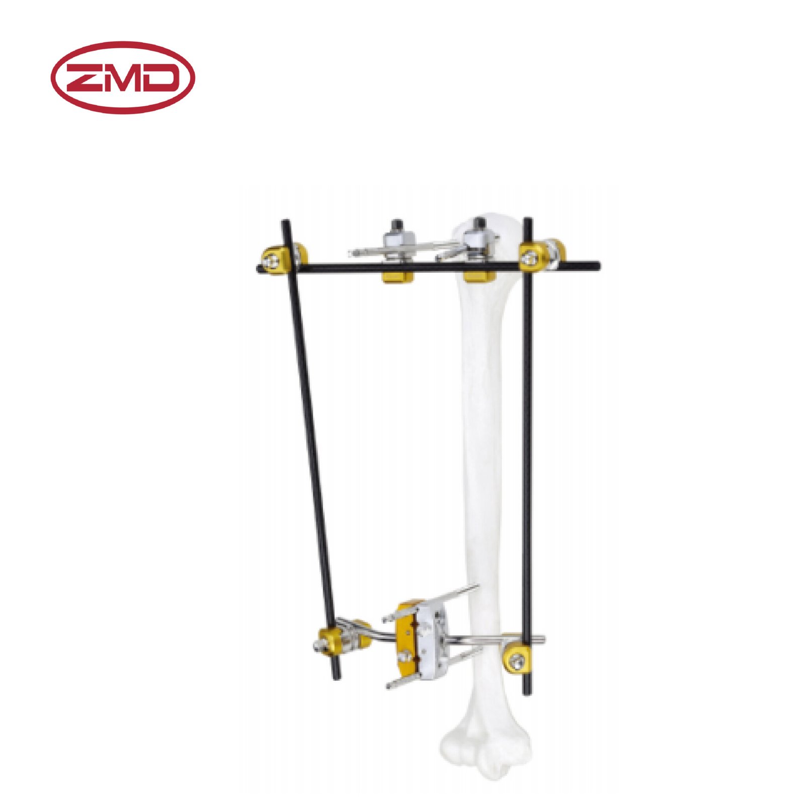 Combined Humeral Proximal External Fixator - Pharmaceutical Company