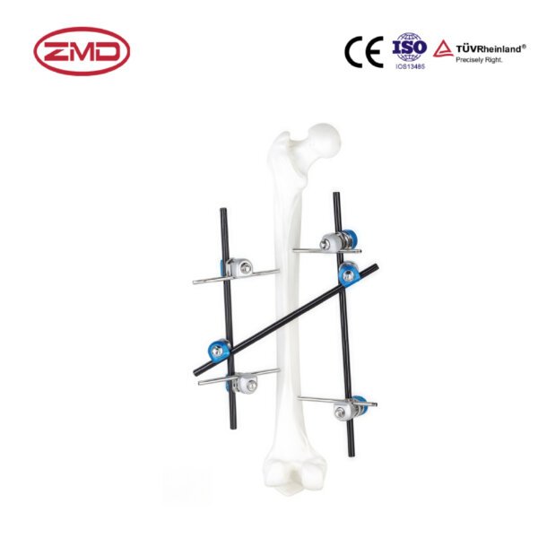 Combined Femoral External Fixator - Pharmaceutical Company