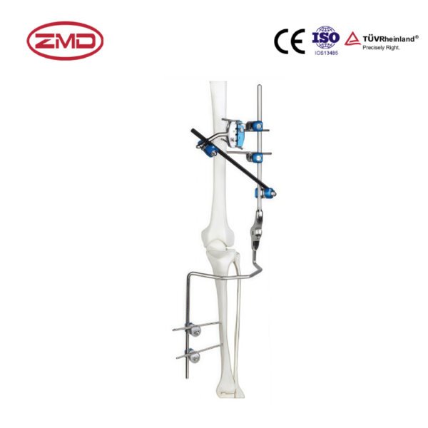 Combined Knee Joint External Fixator - Pharmaceutical Company