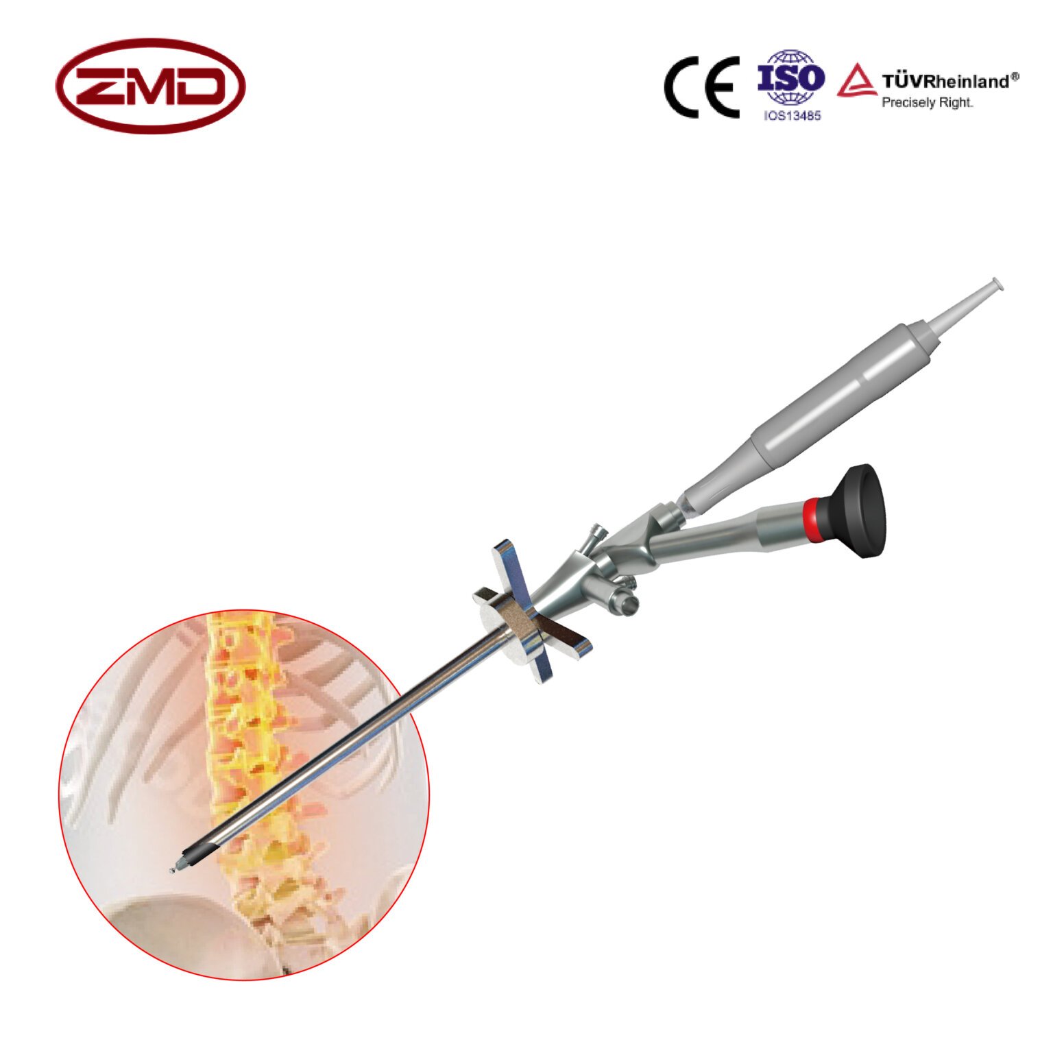 Percutaneous Endoscopic Lumbar Discectomy - Pharmaceutical Company