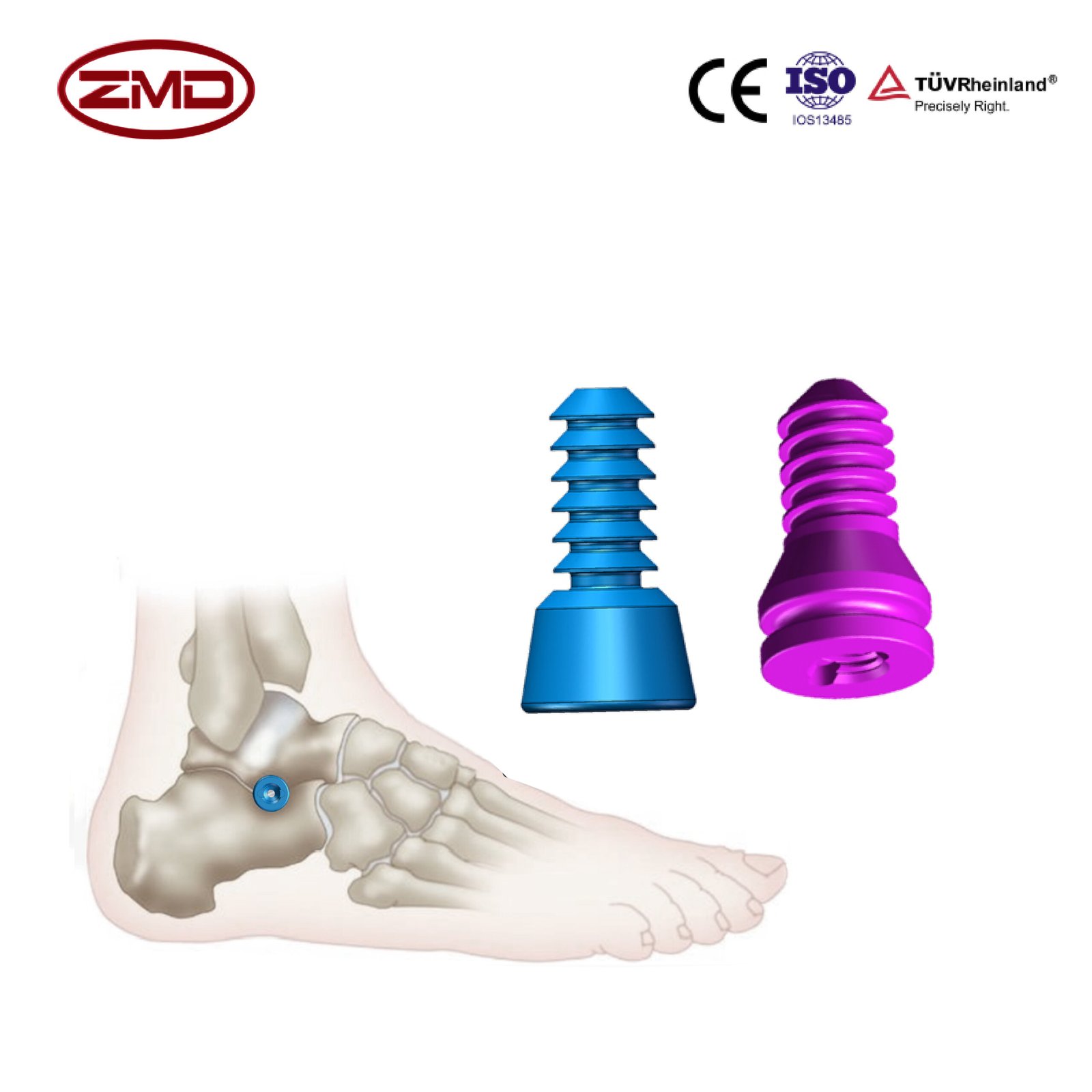 Subtalar Joint Stabilization Screw - Pharmaceutical Company